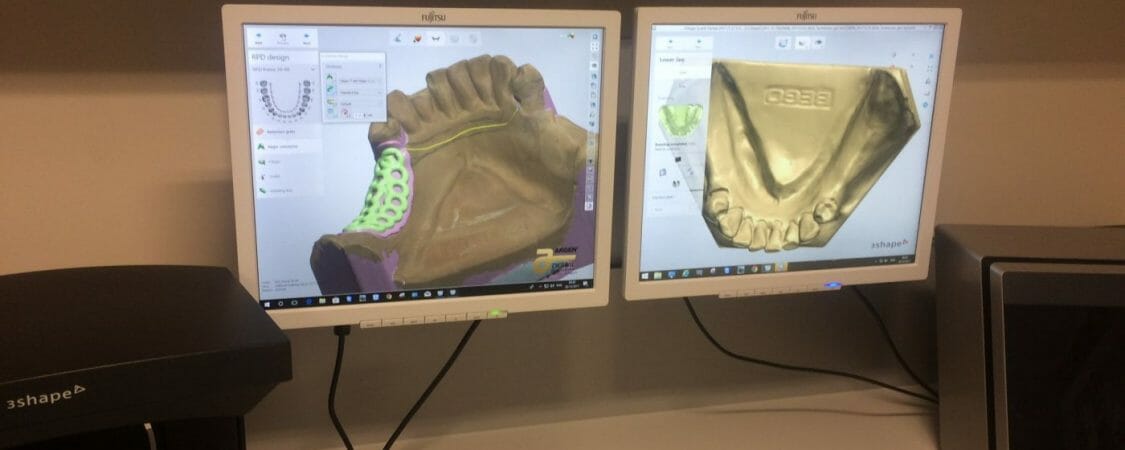 3shape digital scanners - The Natural Denture Clinic