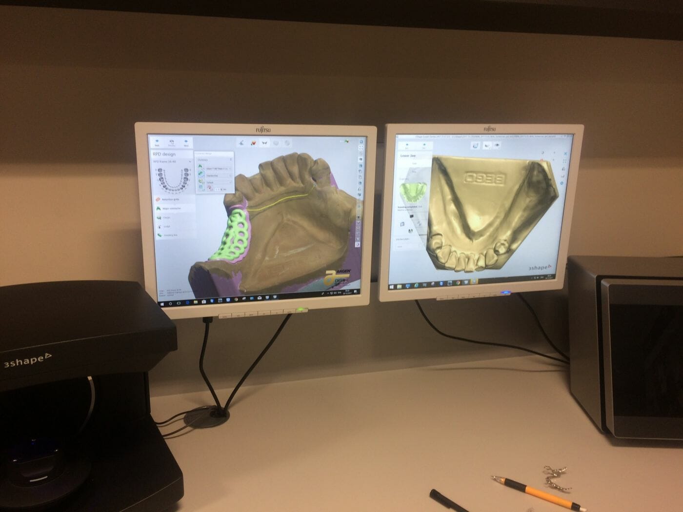 3shape digital scanners - The Natural Denture Clinic