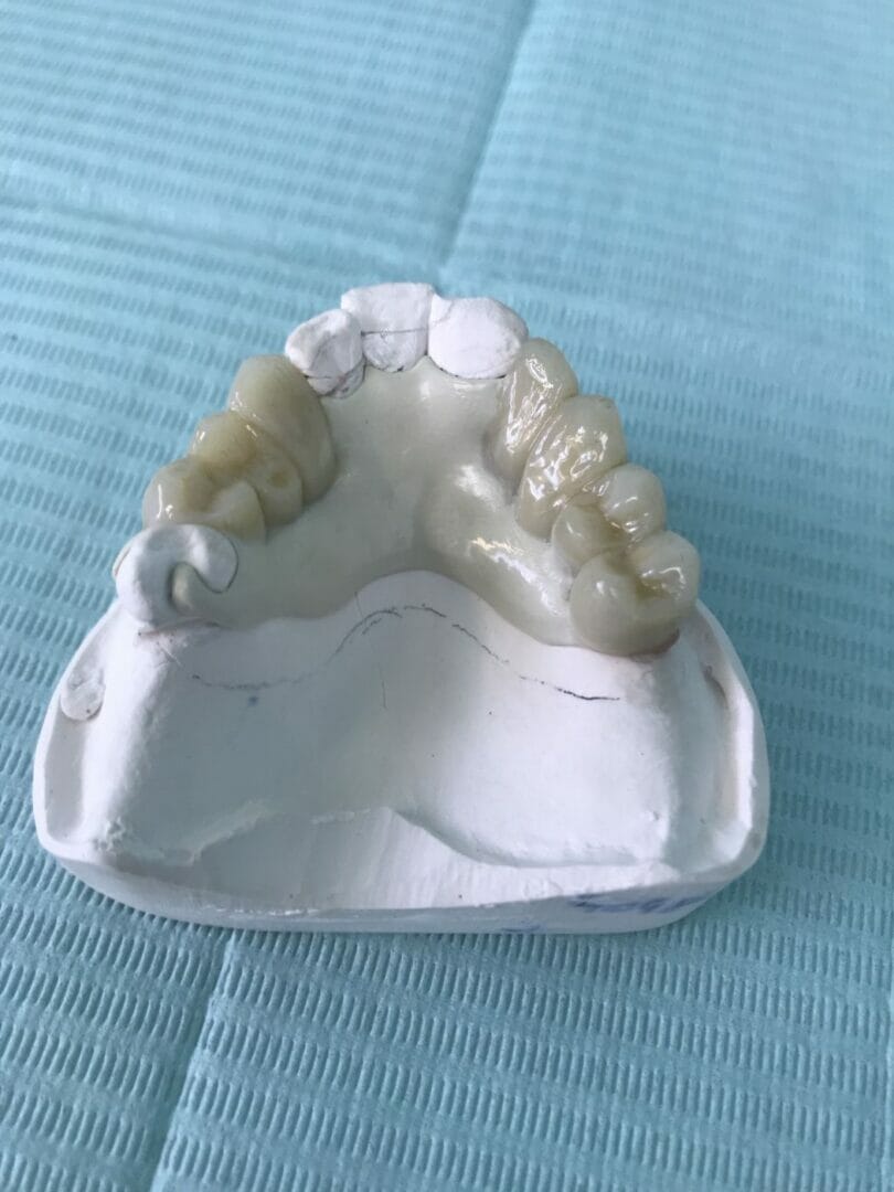 Interesting case - The Natural Denture Clinic